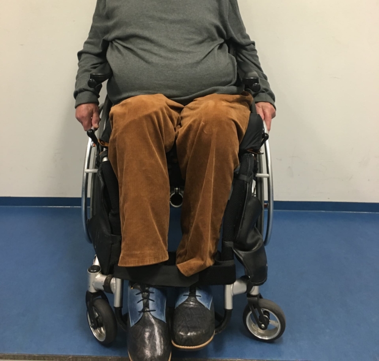 Welke zitproblemen bestaan er? - Check je Zit